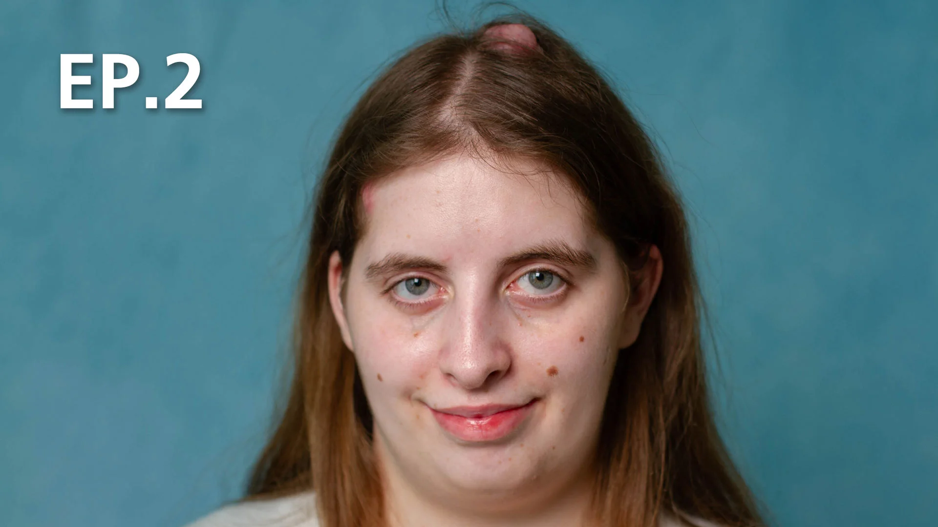 EP.02 | The Face Doctors - Watch Series Online