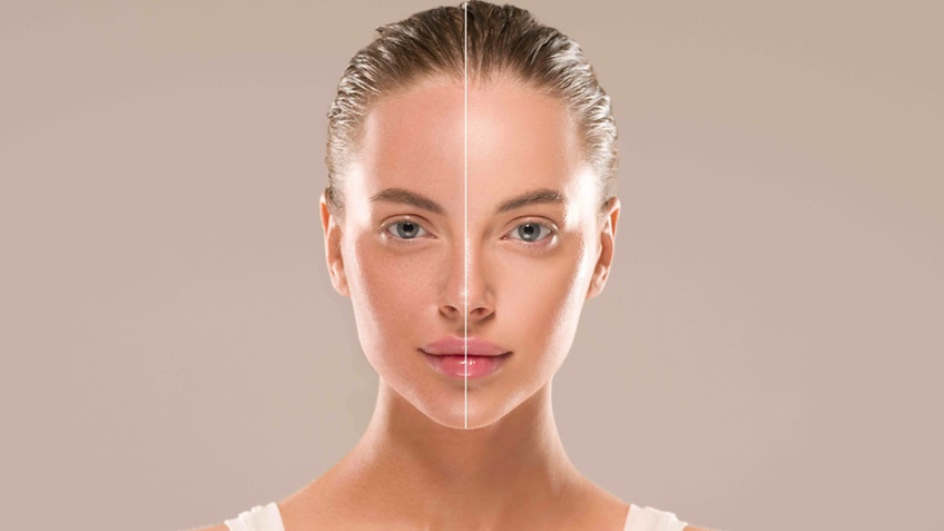 แพทย์ความงามเผยเทคนิคใหม่! สร้าง ‘Highlight & Shading แบบธรรมชาติให้ผิว ...